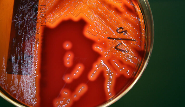 Allvarliga bakterieinfektioner av streptokocker ökar på grund av ...